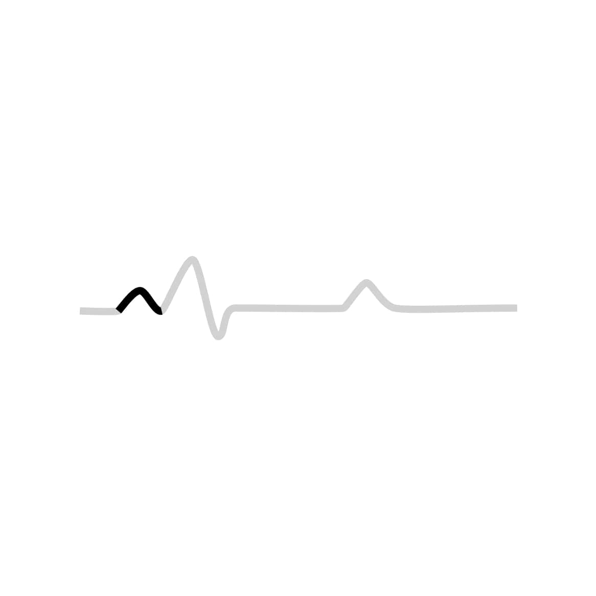 How does an ECG work? Understanding ECG and heart health | Withings