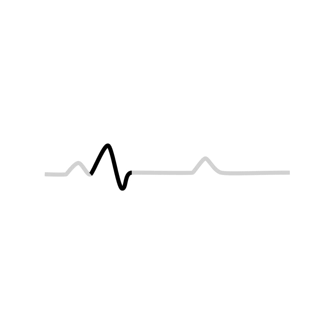 How does an ECG work? Understanding ECG and heart health | Withings