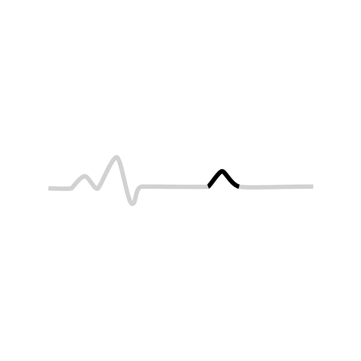 How does an ECG work? Understanding ECG and heart health | Withings